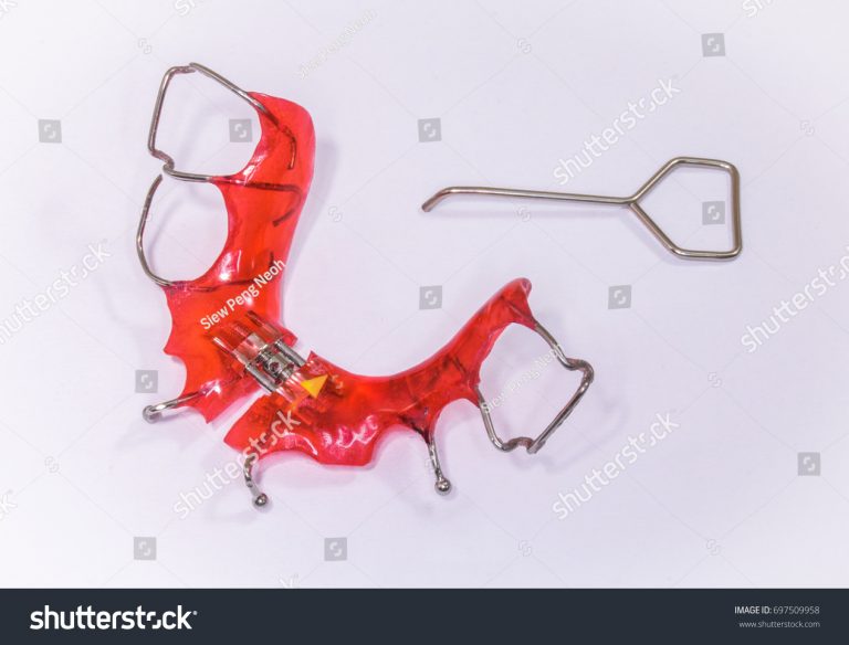 stock-photo-close-up-of-a-removable-orthodontic-appliance-with-a ...